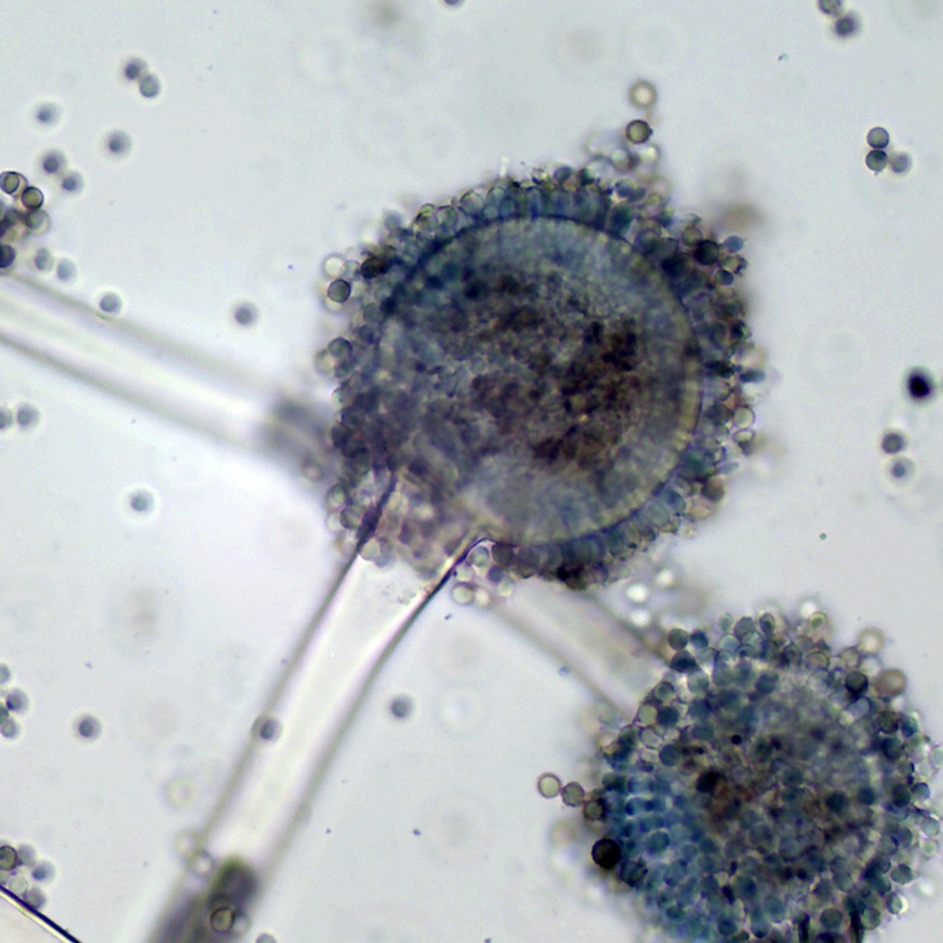 INFECCIONES FÚNGICAS INVASORAS - Observatorio de Enfermedades Infecciosas