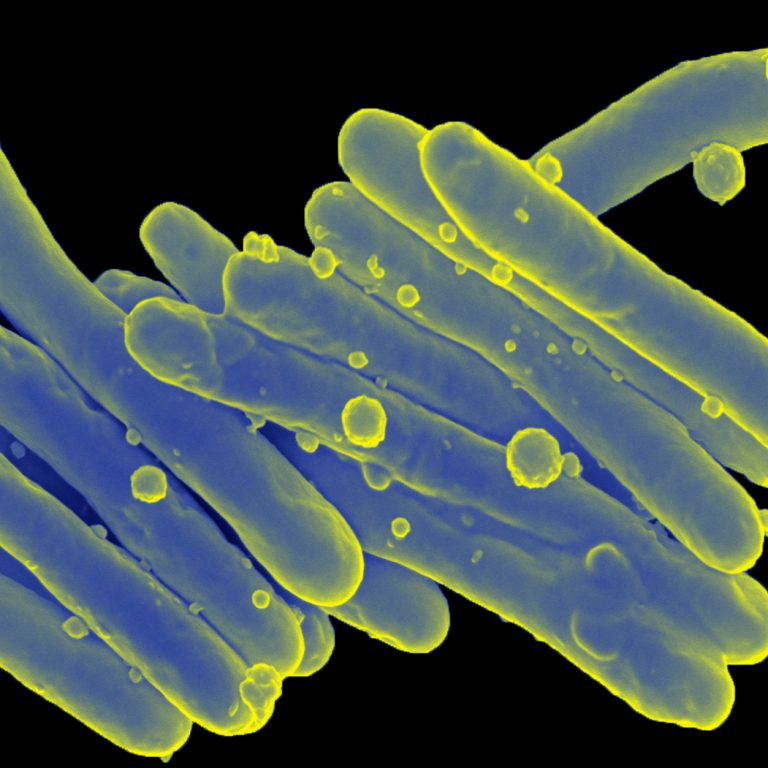 LEPRA - Observatorio de Enfermedades Infecciosas