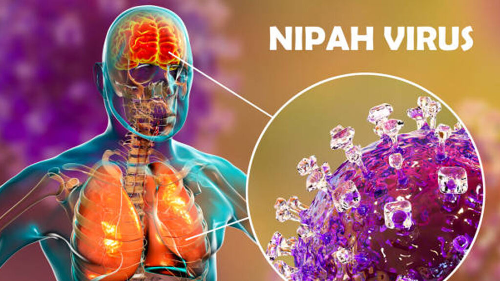 Alerta por brote de virus Nipah - Observatorio de Enfermedades Infecciosas Alerta por brote de virus Nipah - Observatorio de Enfermedades Infecciosas